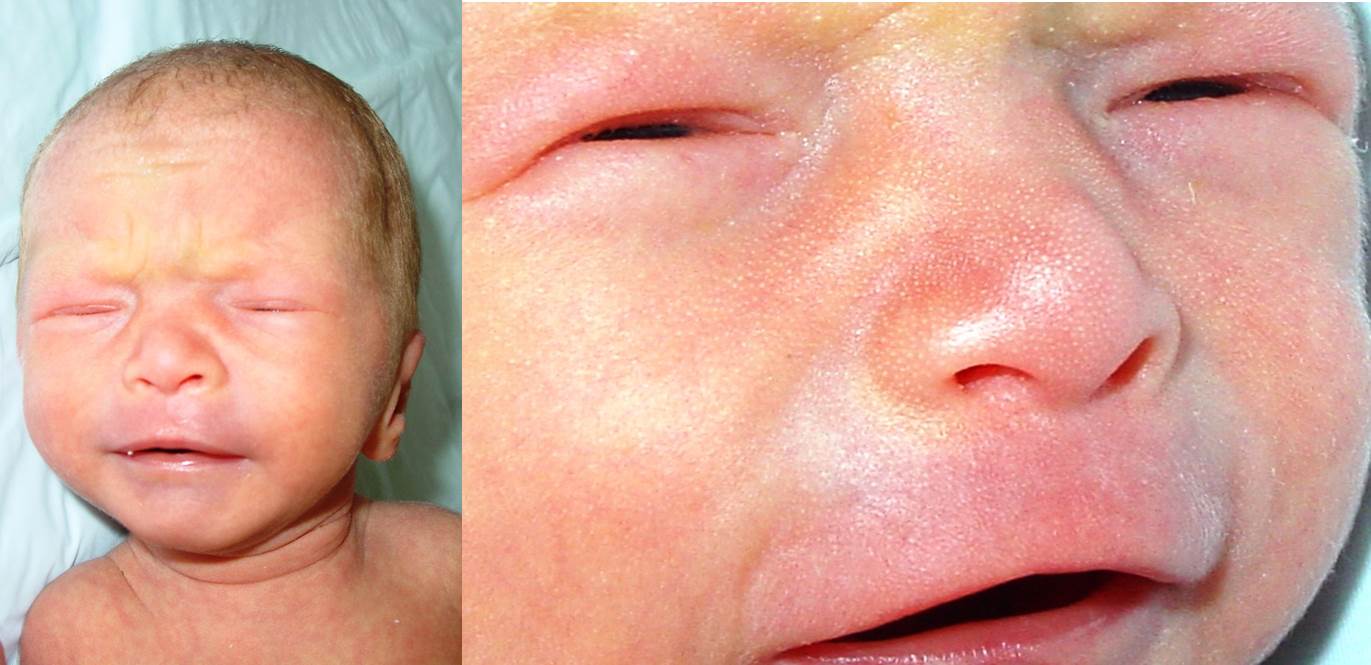 Facies13 – Clinical Eye Openers