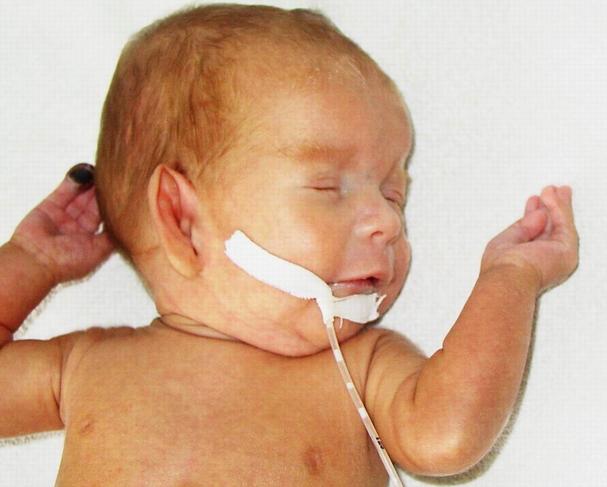 Facies and Angioma – Clinical Eye Openers